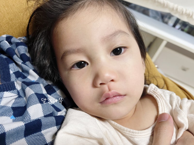 신생아 연어반 원인과 없어지는 시기 아기 딸기혈관종 원인 및 치료법 네이버 블로그