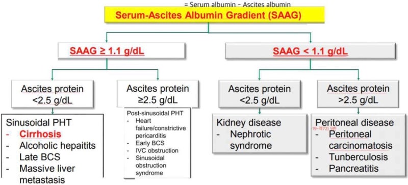 복수(Ascites) :: 원인, 진단, 단계, 분석항목, 감별진단 : 네이버 블로그