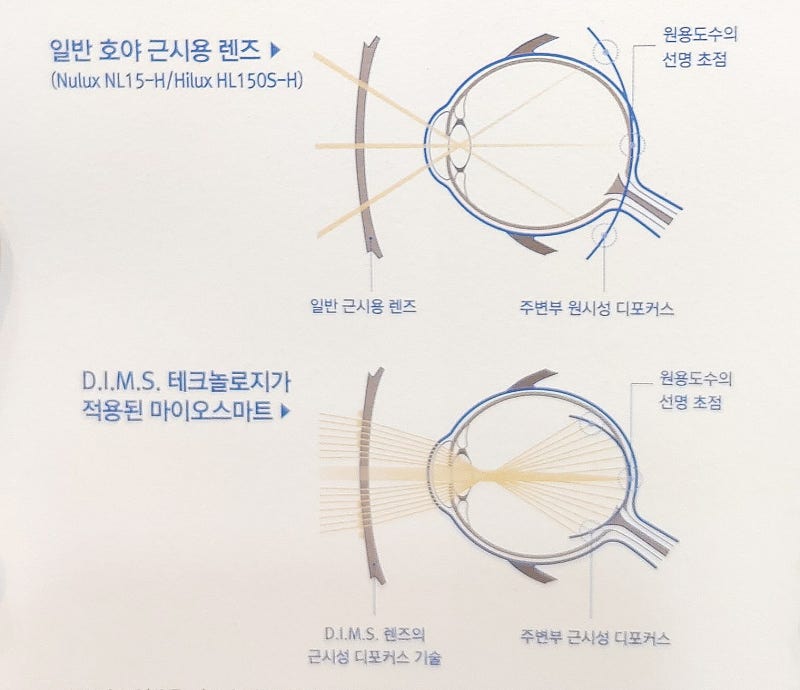 근시진행완화렌즈 마이오비전 마이오스마트 비교 네이버 블로그