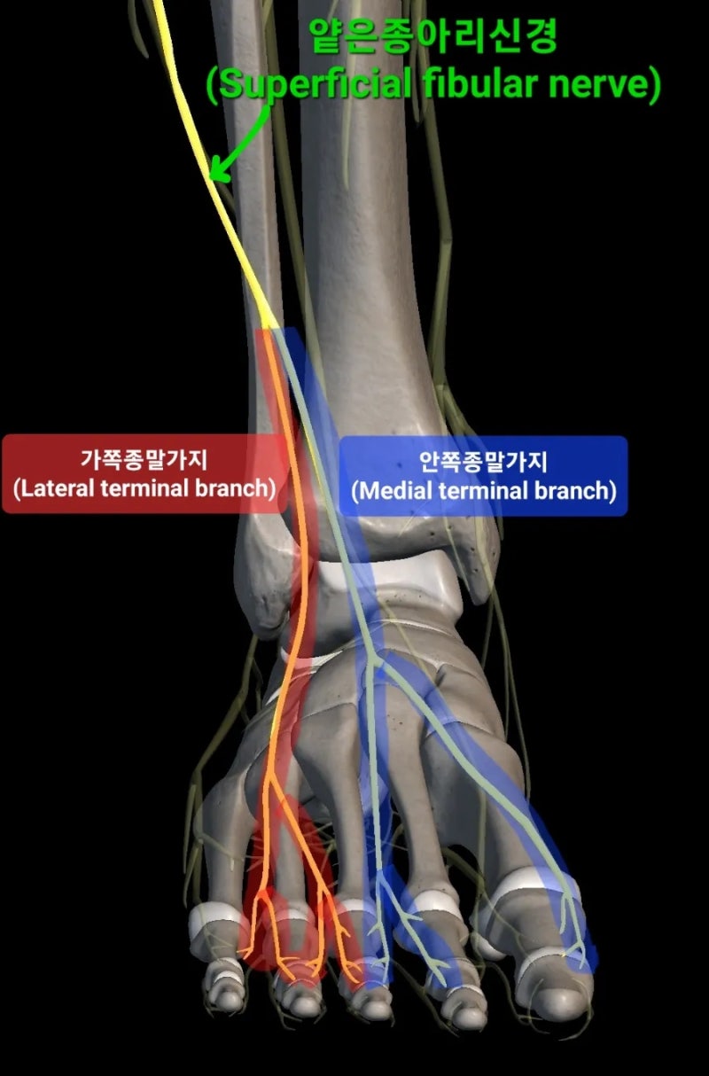 온종아리신경(총비골신경, Common Fibular Peroneal / Nerve), 얕은 / 깊은 종아리신경 ...