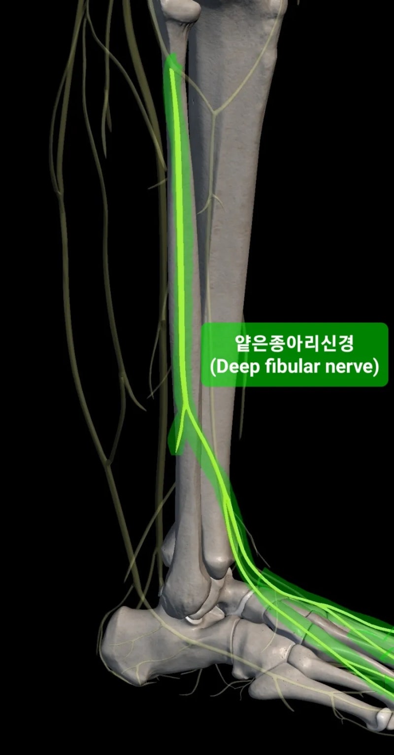 온종아리신경(총비골신경, Common Fibular Peroneal / Nerve), 얕은 / 깊은 종아리신경 ...