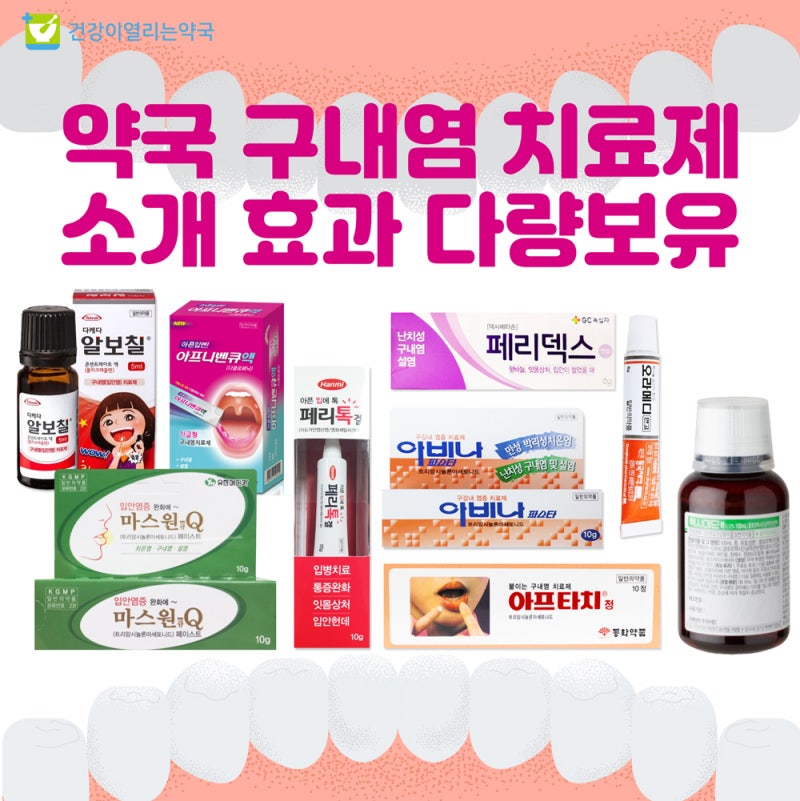 약국 구내염 9종 입안 염증치료제 소개 효과 비교 아프니벤큐 페리톡겔 오라메디 페리덱스 아프타치 마쓰원큐 알보칠 헥사메딘 아비나