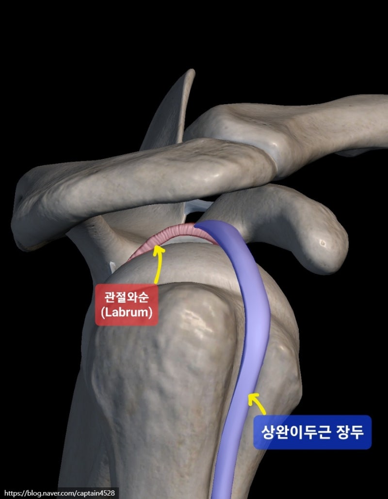 슬랩 병변(SLAP lesion) : 원인과 검사 방법 - O'brien / Kibler / Clunk / Crank test ...