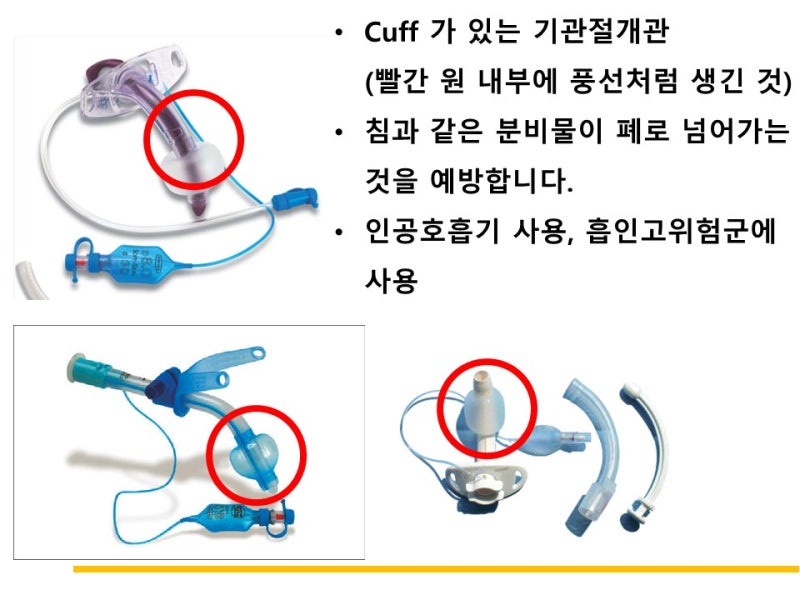 기관절개관의 종류와 관리 네이버 블로그