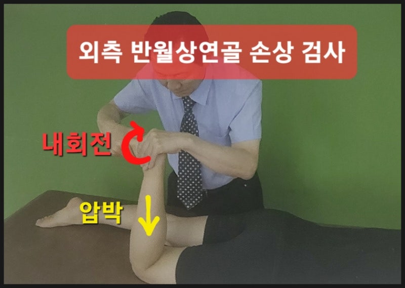 외측 / 내측 반월상연골 (반달연골, Meniscus) 파열 검사 : 아플레이 압박 검사(Apley's Compression ...