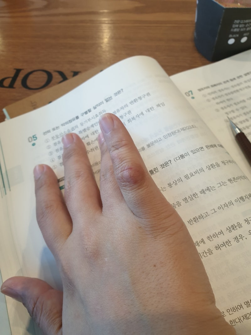 손가락 한포진 원인 및 치료 완치 후기 네이버 블로그