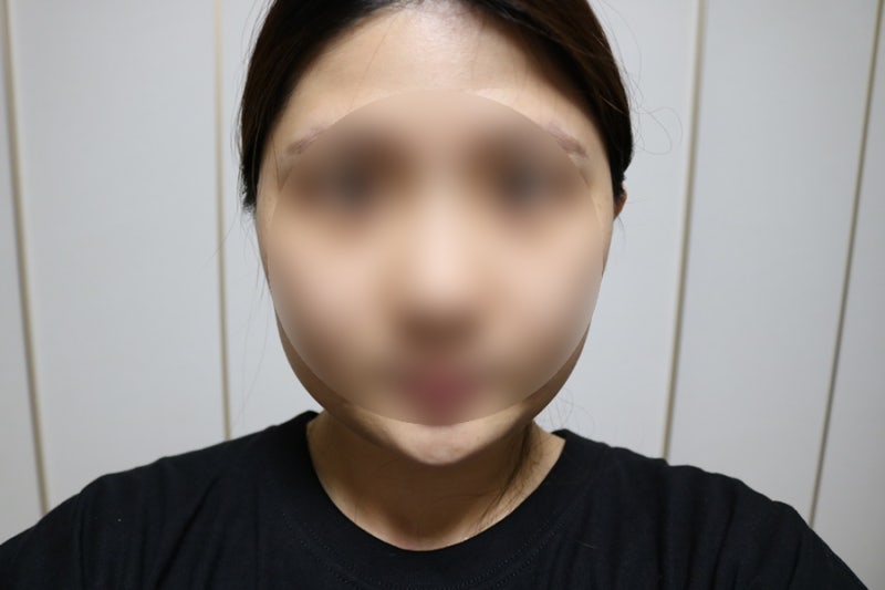 수원웨딩케어 맞춤관리 후기 : 네이버 블로그