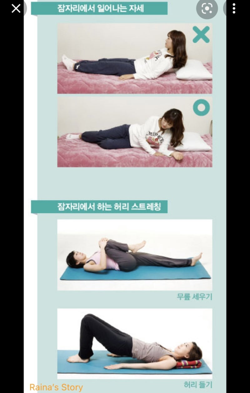 허리 디스크 수술 총정리입원기간 일상생활복귀시점수술종류 수술후관리법 네이버 블로그