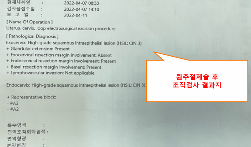 자궁경부원추절제술 후 검사결과가 더 중요한 이유 네이버 블로그