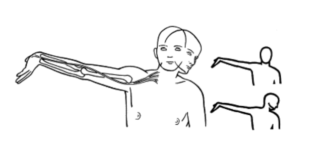 ULTT test Upper Limb Tension Test , Elvey's test : 엘베이 검사 - 상지 신경 긴장 유발 ...