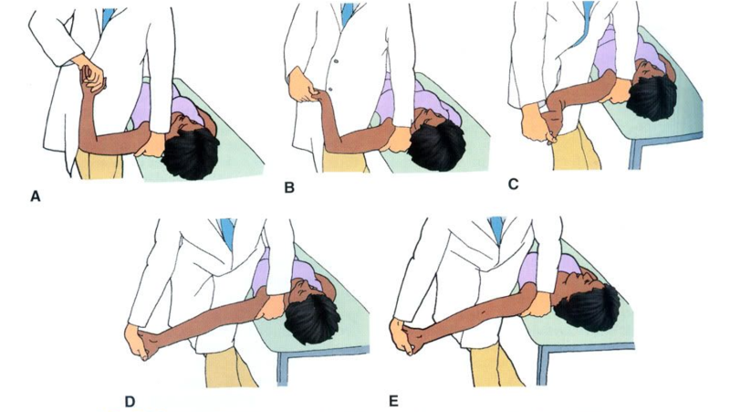 ULTT test Upper Limb Tension Test , Elvey's test : 엘베이 검사 - 상지 신경 긴장 유발 ...