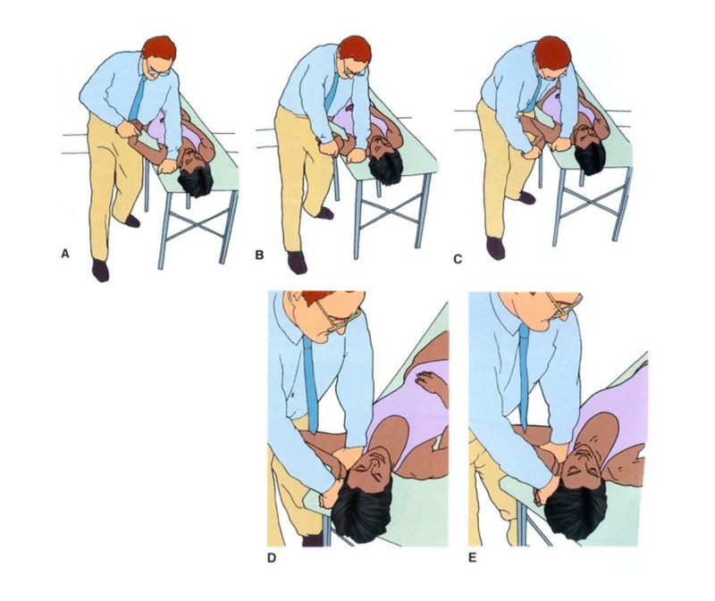 ULTT test Upper Limb Tension Test , Elvey's test : 엘베이 검사 - 상지 신경 긴장 유발 ...