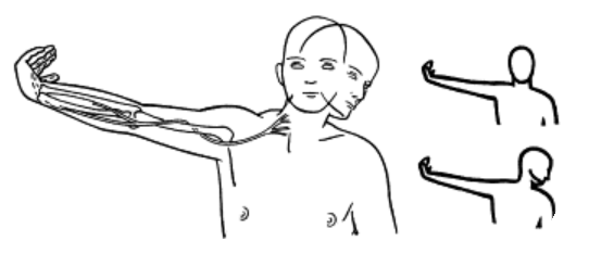 ULTT test Upper Limb Tension Test , Elvey's test : 엘베이 검사 - 상지 신경 긴장 유발 ...