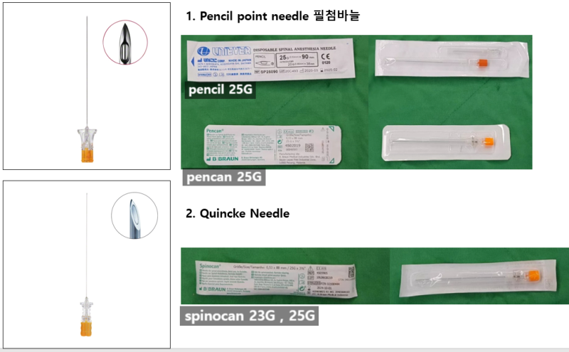 척추마취와 Cse 척추경막외마취 차이점 마취과정 알아보기 네이버 블로그