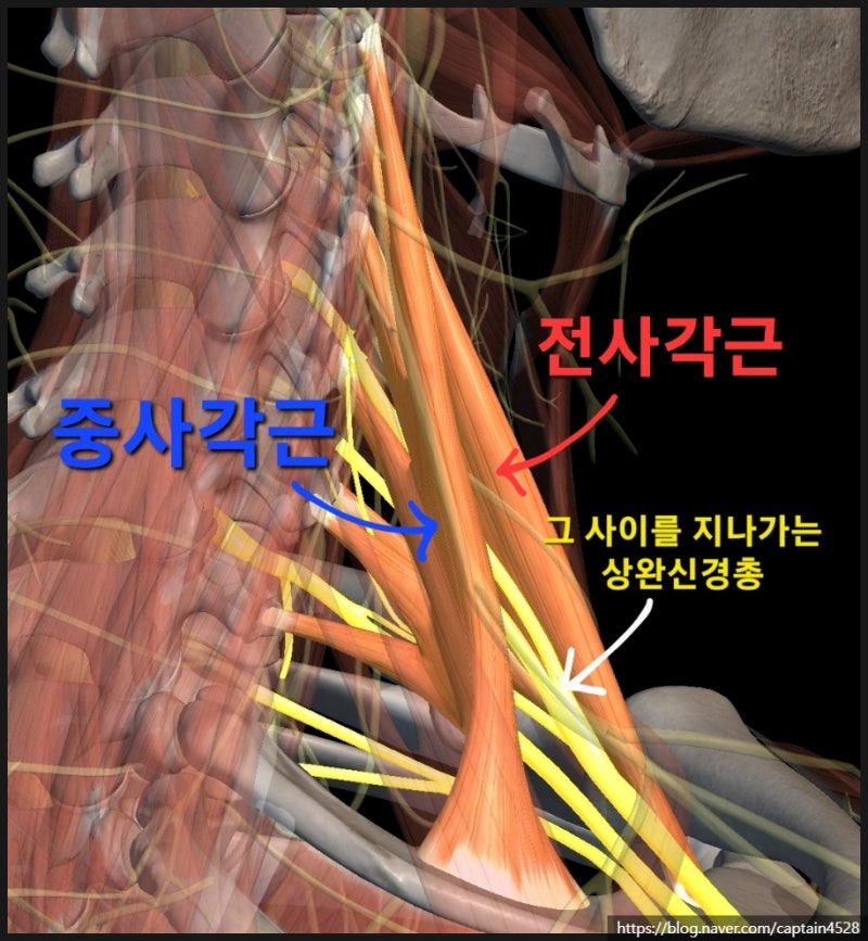 사각근 증후군scalene Syndrome 원인 증상 검사 애드손 검사 할스테드 검사 네이버 블로그