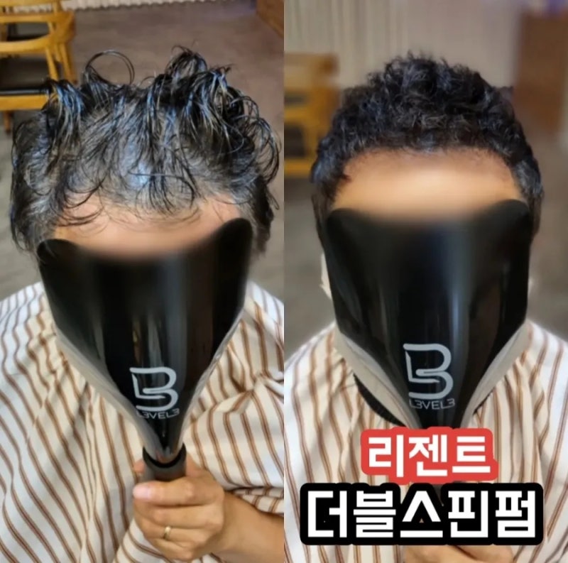 엠자탈모펌 정수리탈모펌 남자탈모펌 정수리탈모파마 M자탈모펌 스핀스왈로 더블스핀펌 네이버 블로그