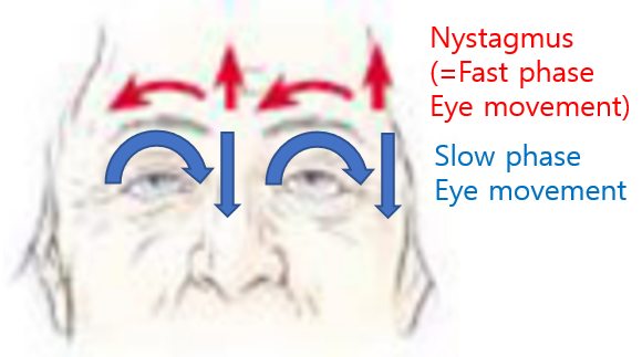 [이석증] 전형적인 BPPV의 안진 공식 : 네이버 블로그