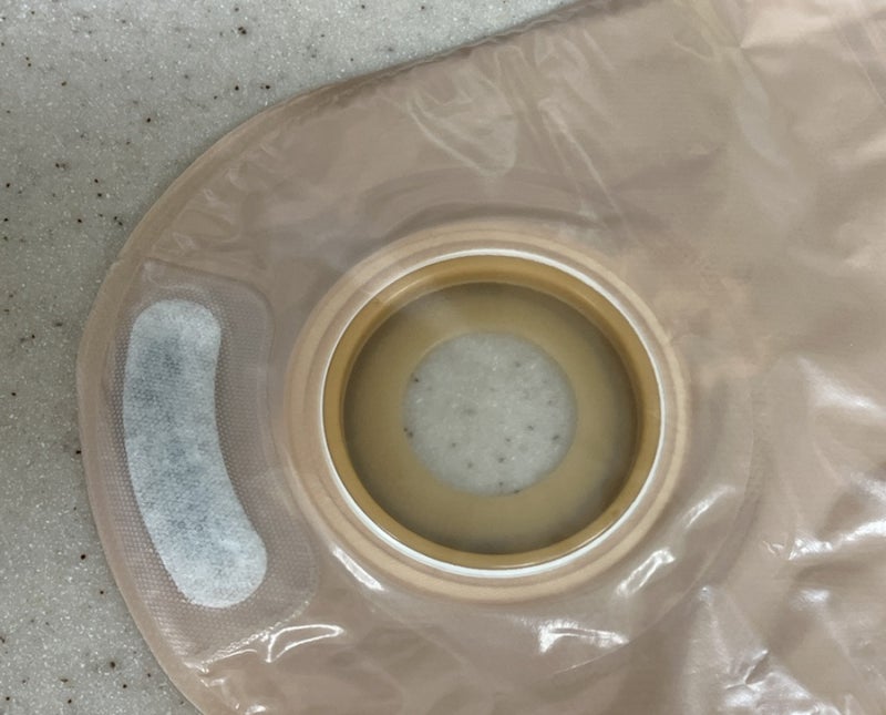 ileostomy, colostomy :: 종류, 정상상태, 교환방법, 합병증 : 네이버 블로그