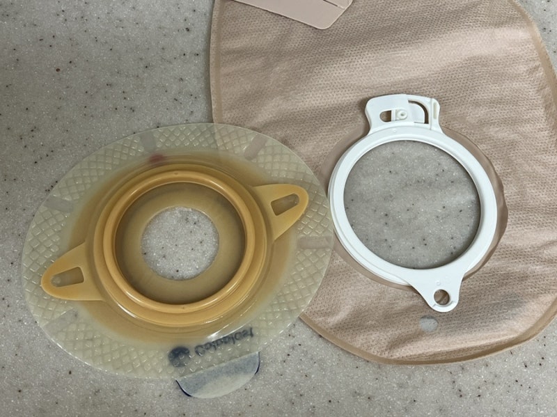 ileostomy, colostomy :: 종류, 정상상태, 교환방법, 합병증 : 네이버 블로그