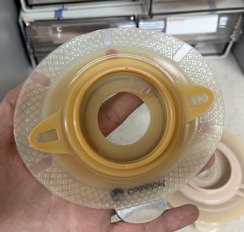 ileostomy, colostomy :: 종류, 정상상태, 교환방법, 합병증 : 네이버 블로그