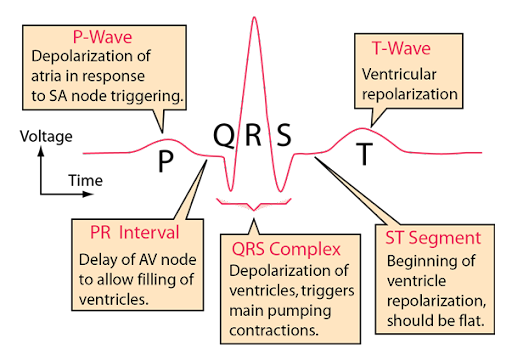 부정맥 PVC, V-tac, V-fib, A-fib, PSVT : 네이버 블로그