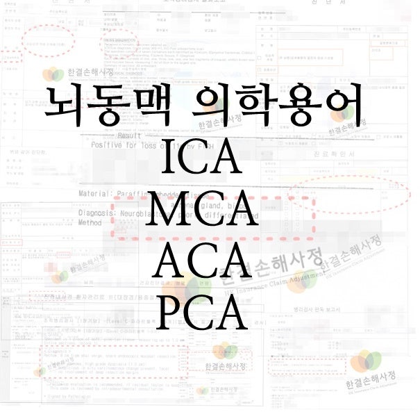 뇌동맥 의학용어 ICA, MCA, ACA, PCA 뜻 : 네이버 블로그
