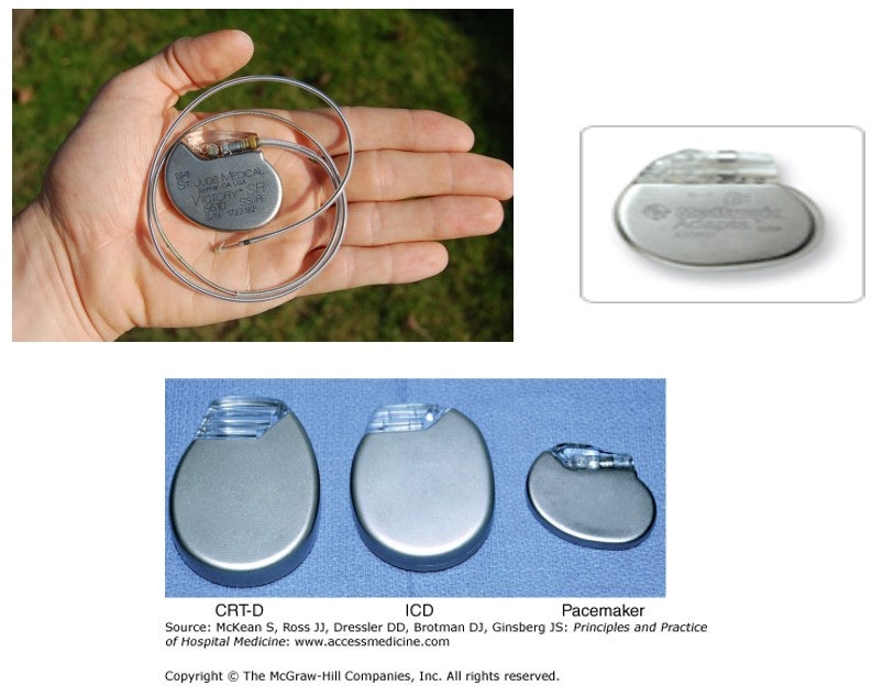 인공 심박동기 종류, 적응증 및 간호 (feat. Temporary, External, Permanent pacemaker ...