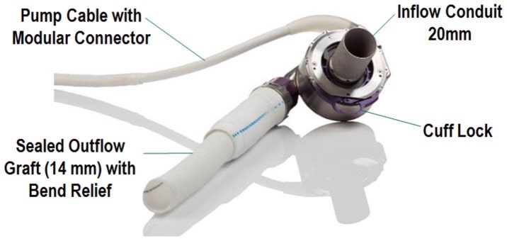 3세대 LVAD(HM3) : 네이버 블로그