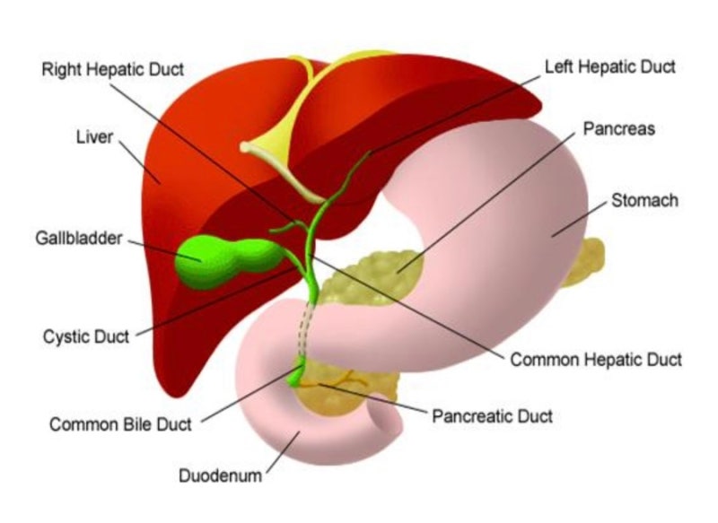 PTBD와 PTGBD란?? : 네이버 블로그