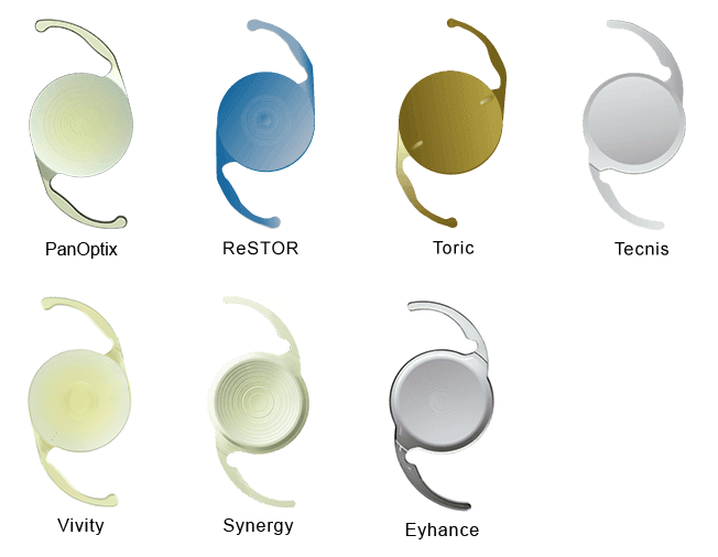 백내장 수술 인공수정체(IOL ; Intraocular lens)종류 : 네이버 블로그