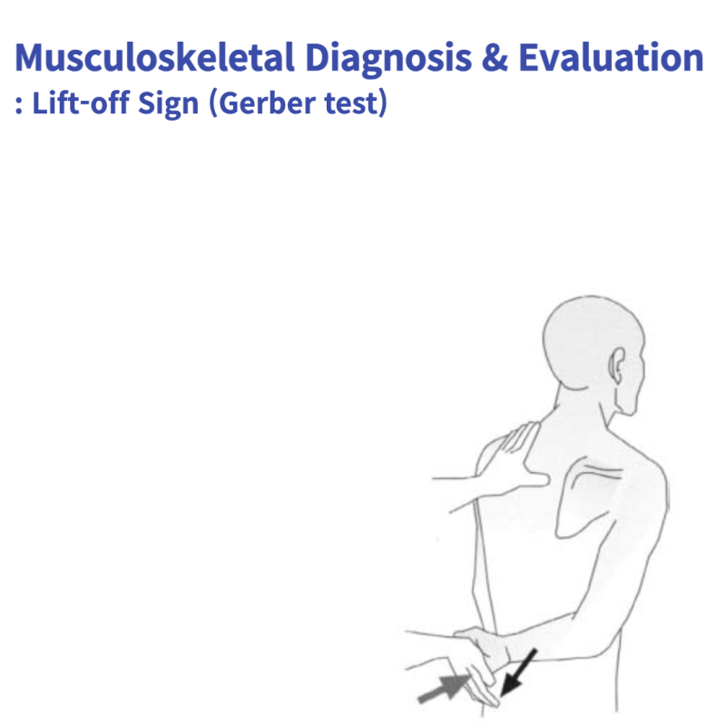 Lift off sign (Gerber test) : 리프트 오프 테스트(거버 테스트) - 어꺠밑근 검사 : 네이버 블로그