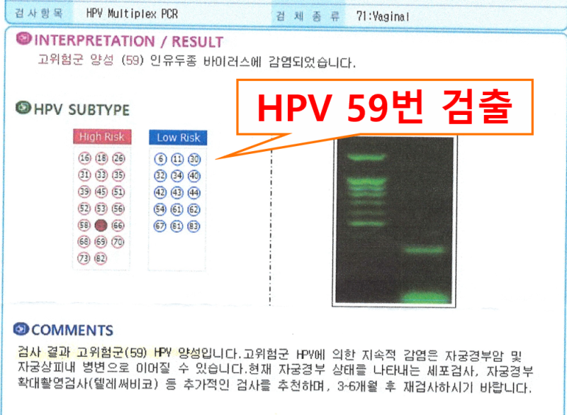 Hpv 바이러스가 검출되면 자궁경부암 자궁경부암 검사 결과지 보는 법 빗속의 여인