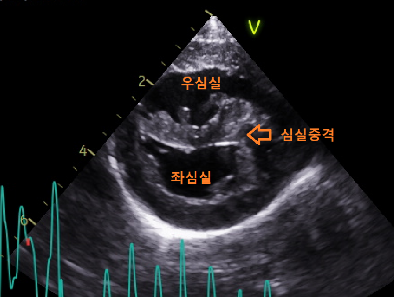 강아지 선천성 심장병 / 동맥관개존증 / PDA / L to R shunt / R to L shunt / 폐성고혈압 / PH ...