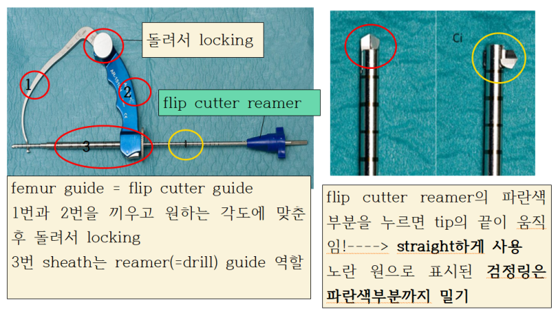 수술실 신규간호사를 위한 ACL reconstruction : 네이버 블로그