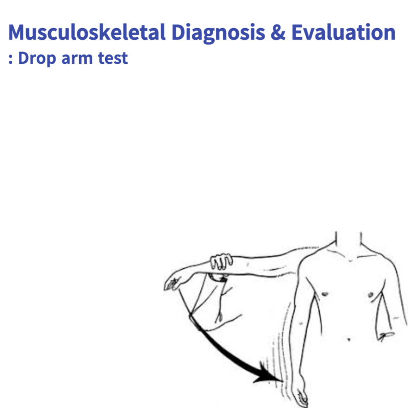 Drop arm test : 드롭암 테스트 - 가시위근 평가 : 네이버 블로그