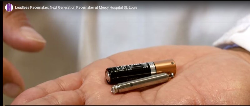 [인공 심박동기 2편] 무선 인공 심박동기/전극선이 없은 심박동기/Leadless pacemaker/Micra : 네이버 블로그