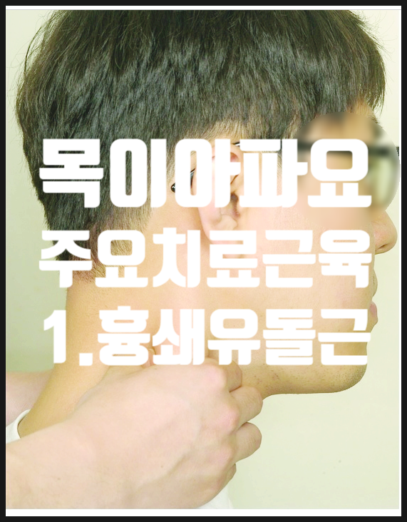 목이 아파요 주요 치료근육 1흉쇄유돌근목빗근 Scm 작용 역할 문제가 생겼을때 네이버 블로그