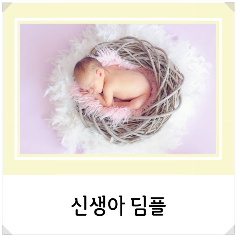 신경관 결손과 연관된 신생아 딤플 아기 엉덩이 보조개 사진 있음 네이버 블로그