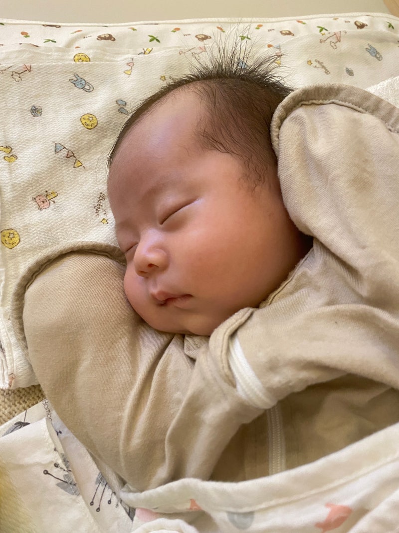 새해 육아기록 신생아 일상 독성홍반 육아종 네이버 블로그