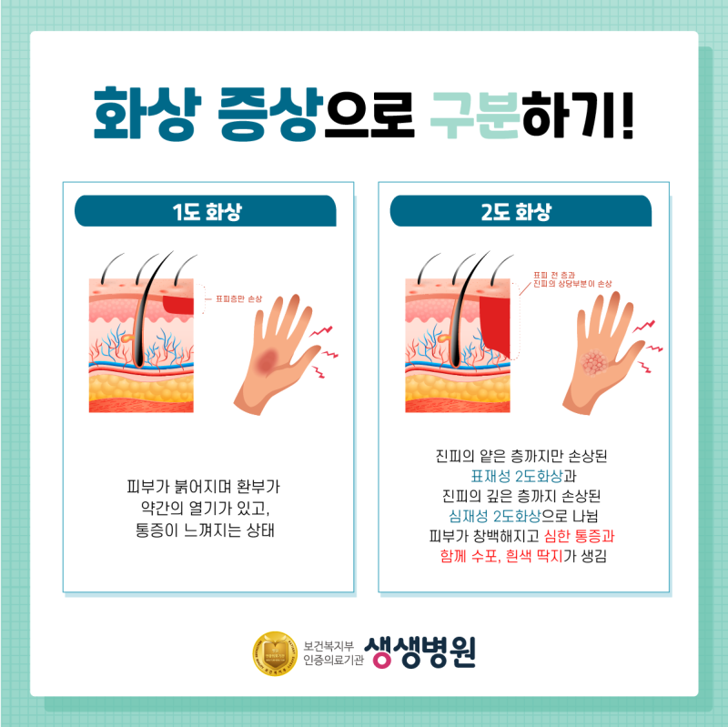 2도 화상 물집 치료 심재성 2도화상 치료법과 특징 네이버 블로그