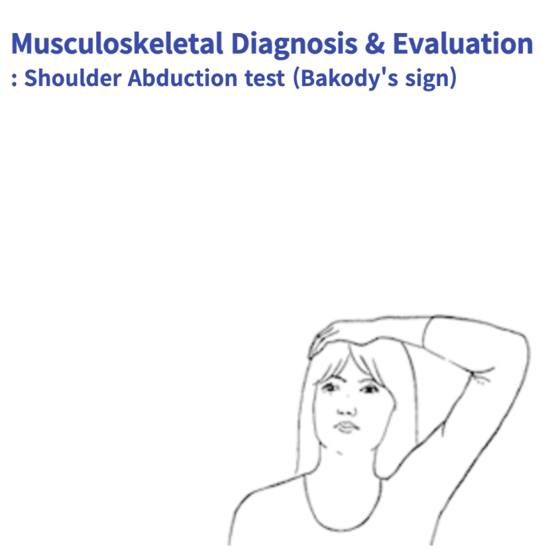 Shoulder Abduction test (Bakody's sign) : 어깨 벌림 테스트 (바코디징후) - C4-6 신경병증 ...