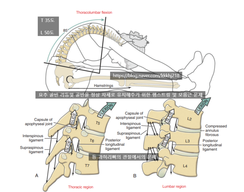 Forward bending test 의 평가 및 치료!! / Adams test : 네이버 블로그