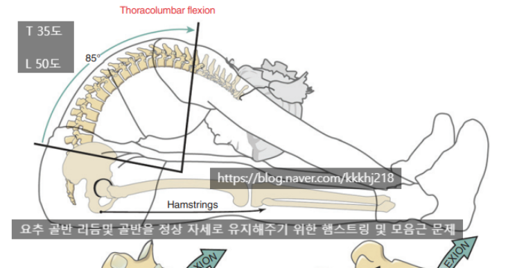Forward bending test 의 평가 및 치료!! / Adams test : 네이버 블로그
