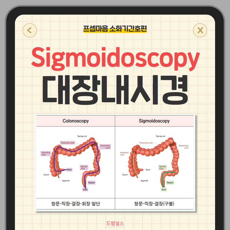 sigmoidoscopy vs colonoscopy 차이점, 주의점 : 네이버 블로그