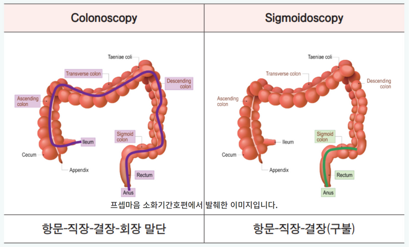 sigmoidoscopy vs colonoscopy 차이점, 주의점 : 네이버 블로그