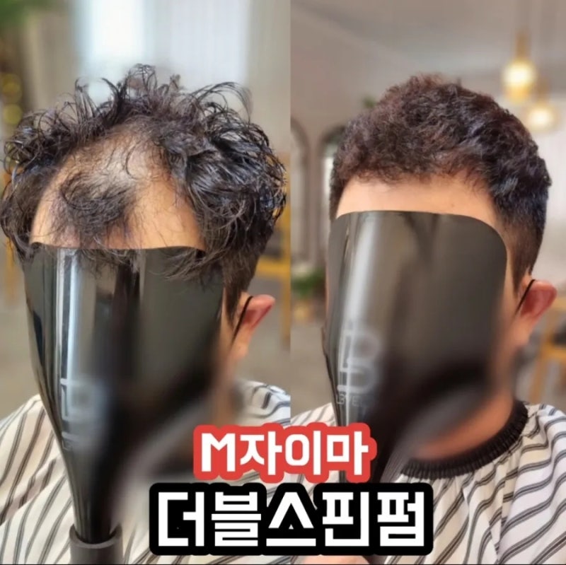 인천 부평 부천머리숱 없는 남자펌 M자탈모파마 탈모펌 남자탈모펌 정수리 송도탈모파마 M자탈모 네이버 블로그