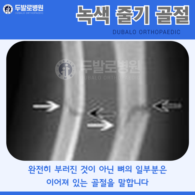 서울소아정형외과 소아 골절의 종류에 대해서 알려드리겠습니다 네이버 블로그