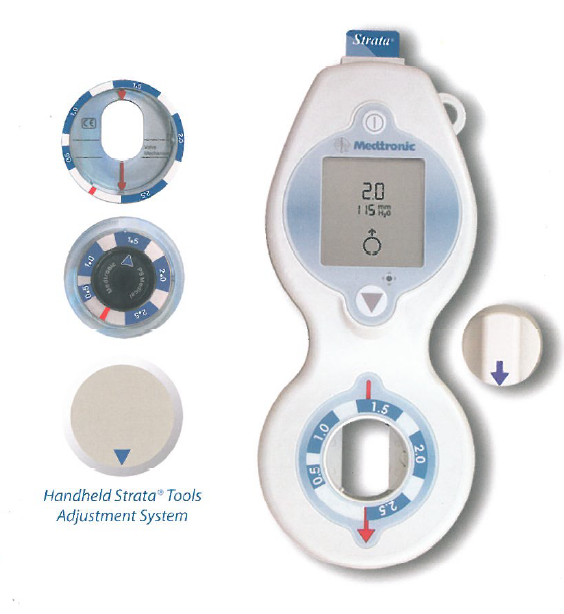 [Hot News]메디레이, VP Shunt 조절밸브 공급확대 : 네이버 블로그