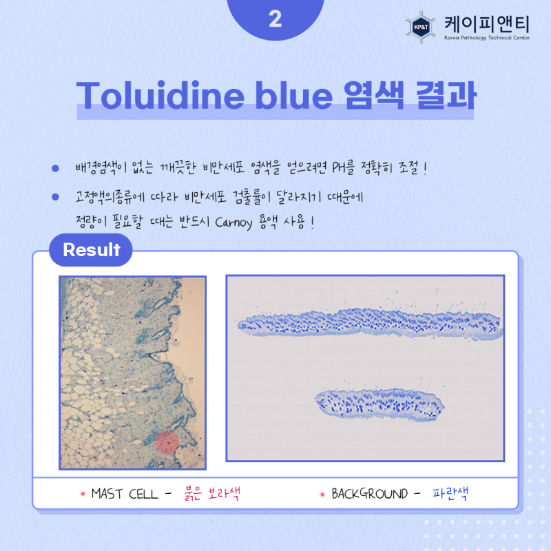 비만세포 관찰에 탁월한 Toluidine blue를 알아볼까요? : 네이버 블로그