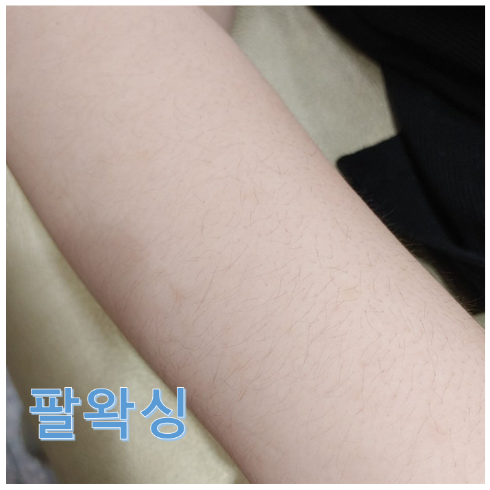 창원 마산 팔왁싱 시술 전후 사진 왁싱 잘하는 곳 마이뷰티 창동 따뜻하고 더워지는 날씨에는 필수 여름 준비 네이버 블로그